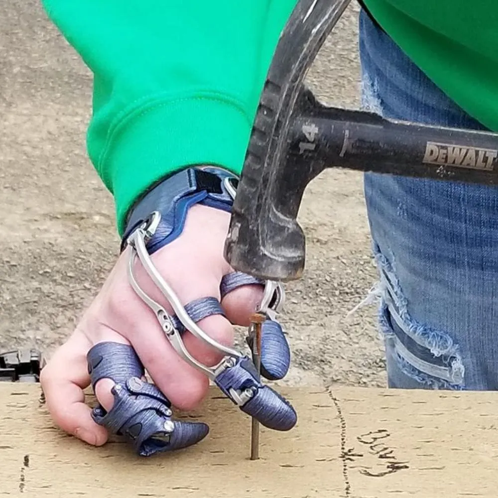 Custom Upper Limb Prosthetics — Tillges Orthotics & Prosthetics