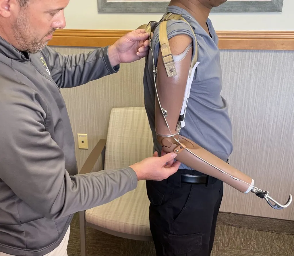 Upper Limb Prosthesis Peripheral Interfaces For Upper Limb Prosthetics